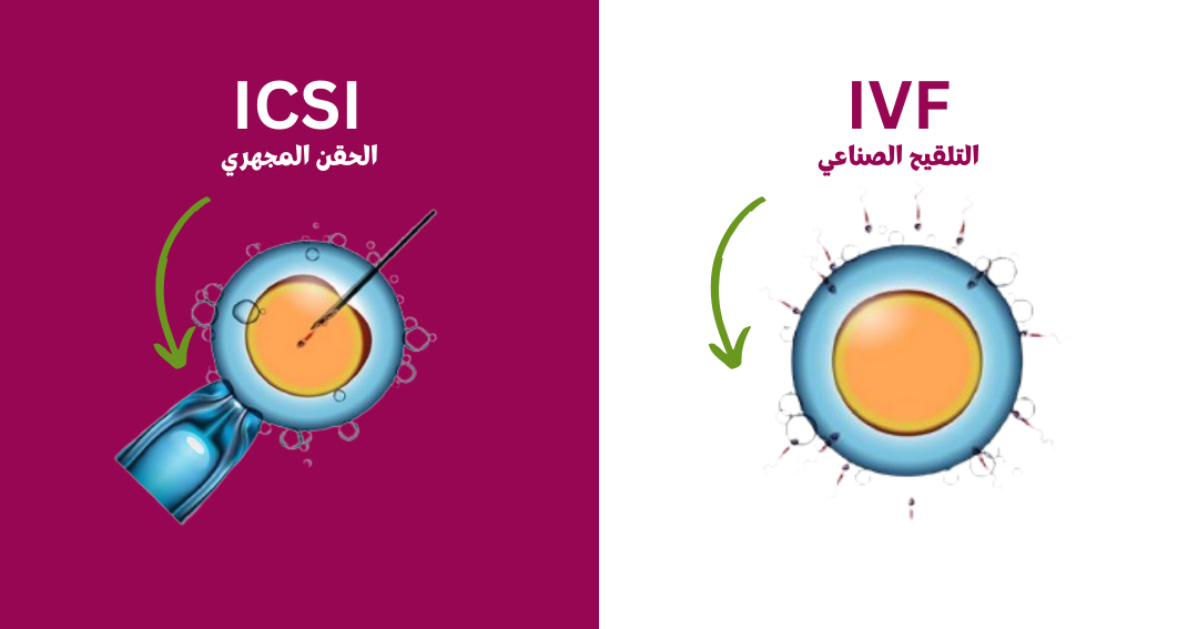 The difference between Intracytoplasmic Sperm Injection (ICSI) and In ...